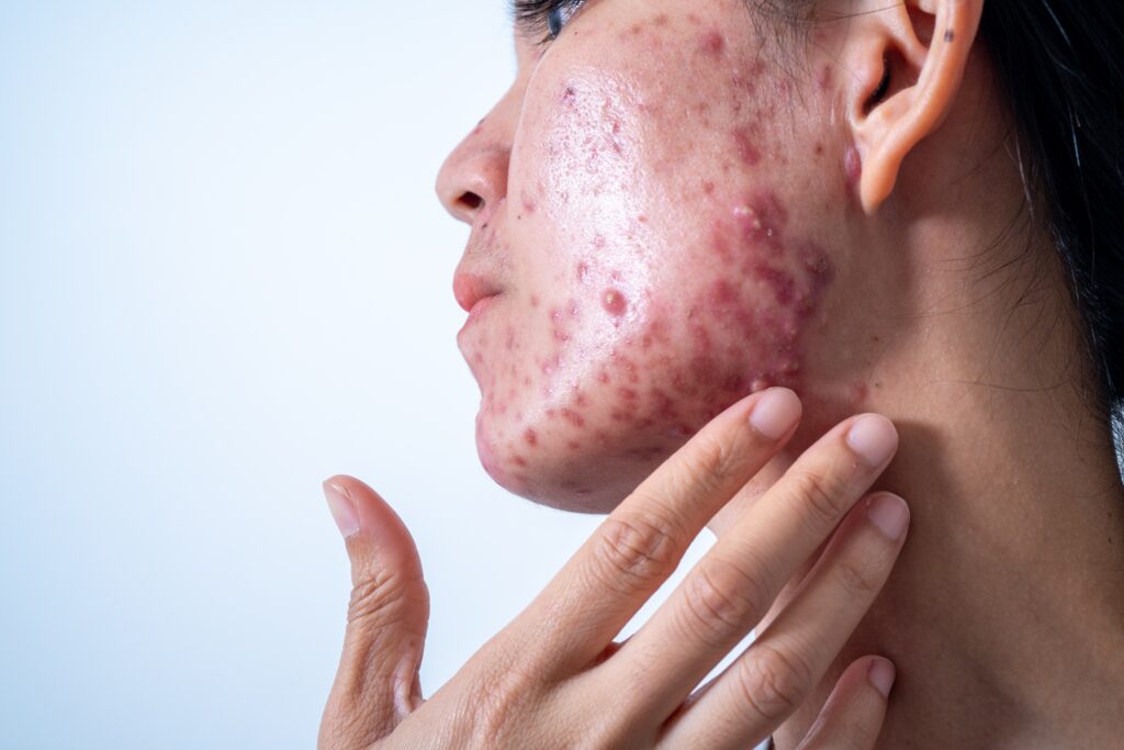 I'm a HMGS Dermatologist. These are 5 Facts you should know about ...